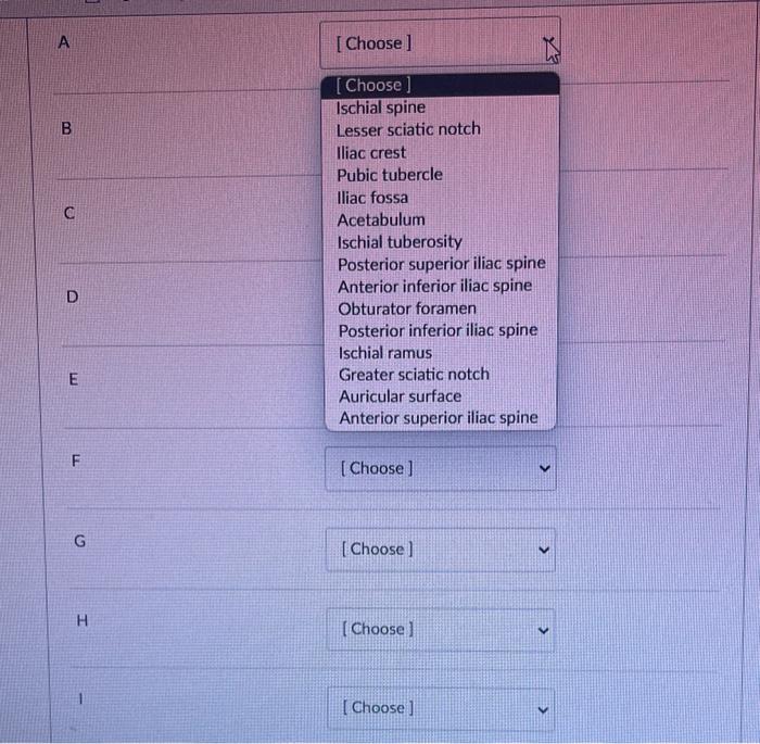 Solved This model of the coxal bone (or similar model) is | Chegg.com