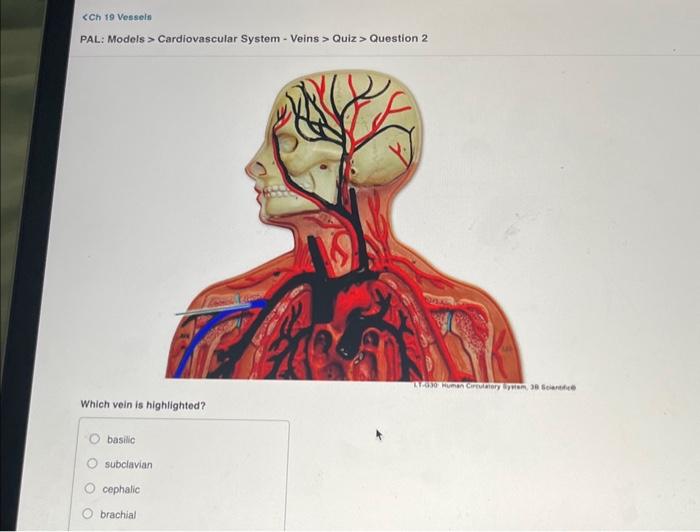 Solved PAL: Histology > Cardiovascular System > Lab | Chegg.com