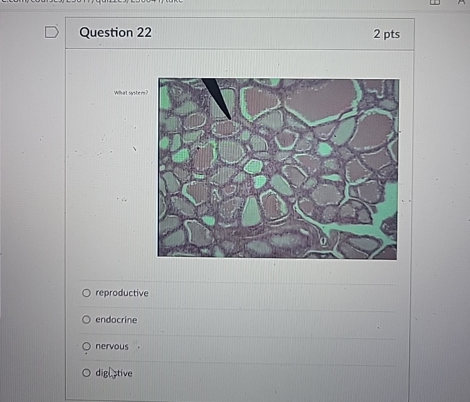 Solved Question 222 ﻿pts | Chegg.com