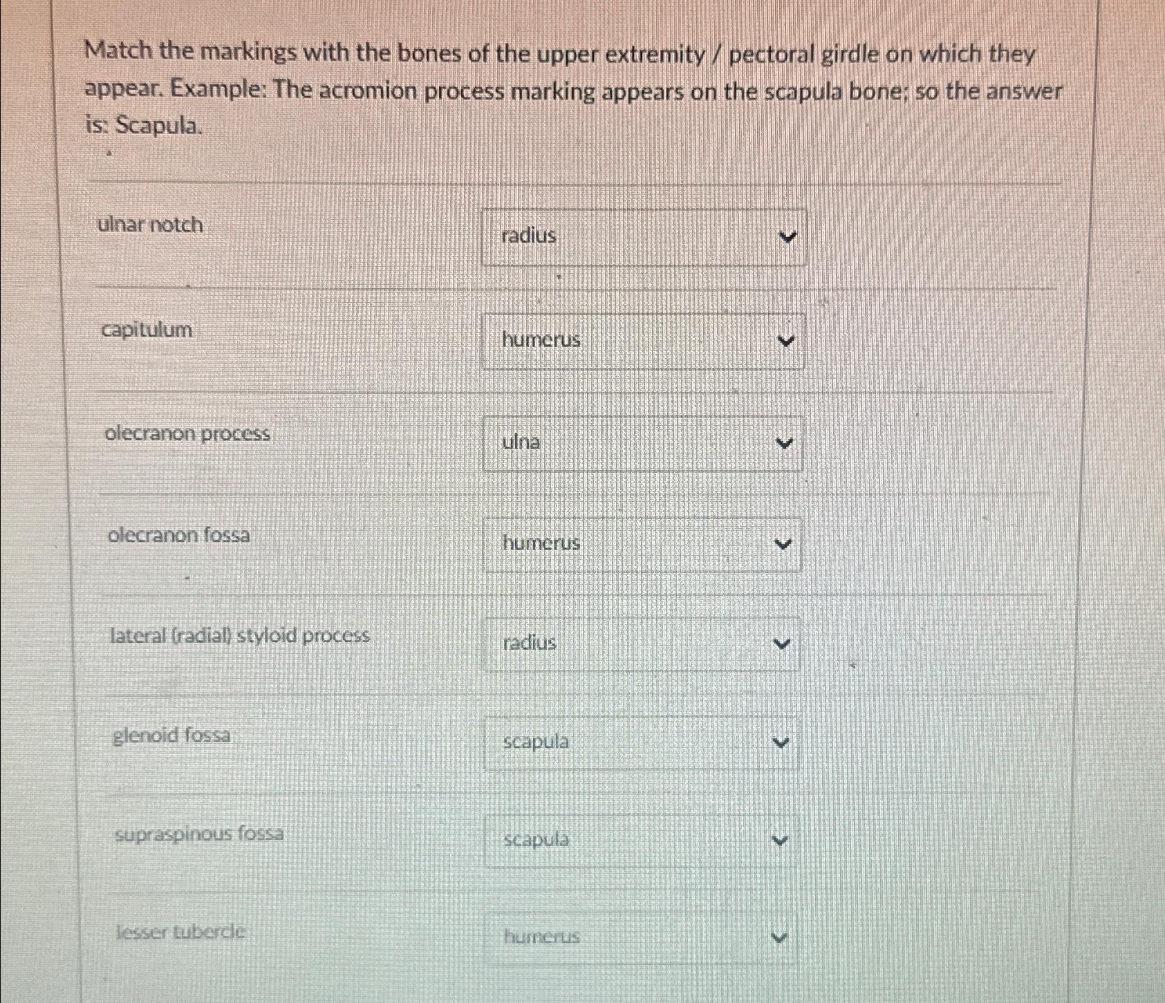Solved Match the markings with the bones of the upper | Chegg.com