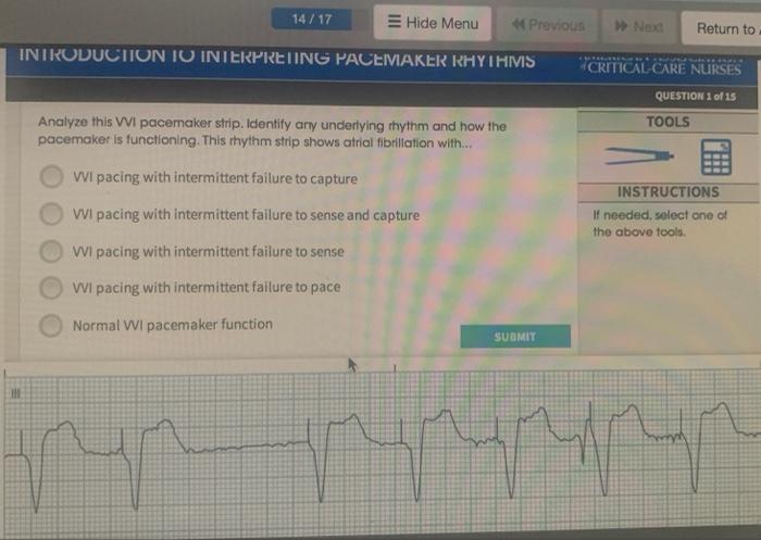 Solved Analyze this WVi pacemaker strip. Identify ary | Chegg.com