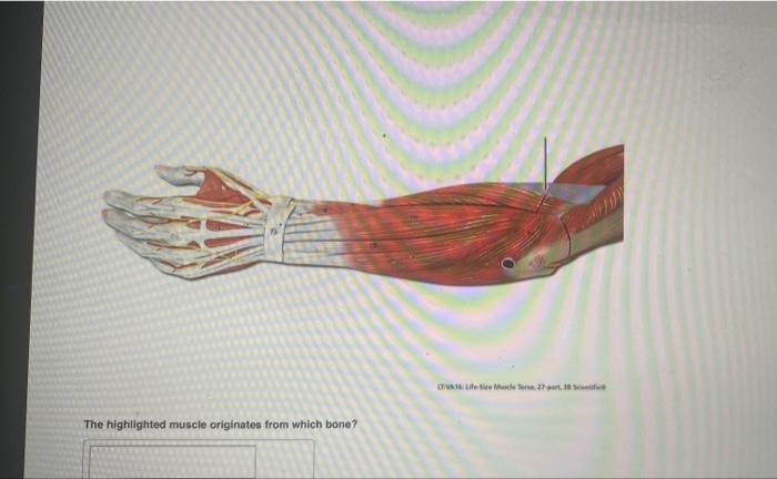 Solved The highlighted muscle originates from which bone? | Chegg.com