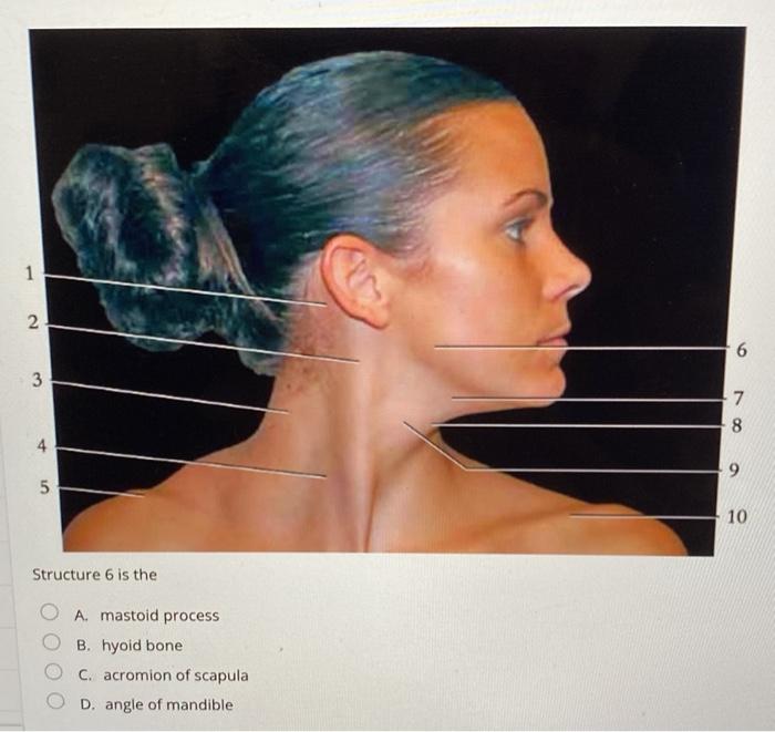 Solved 1 2 6 3 7 8 4 9 5 10 Structure 6 is the A. mastoid | Chegg.com