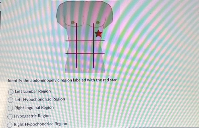 Solved Identify the abdominopelvic region labeled with the | Chegg.com