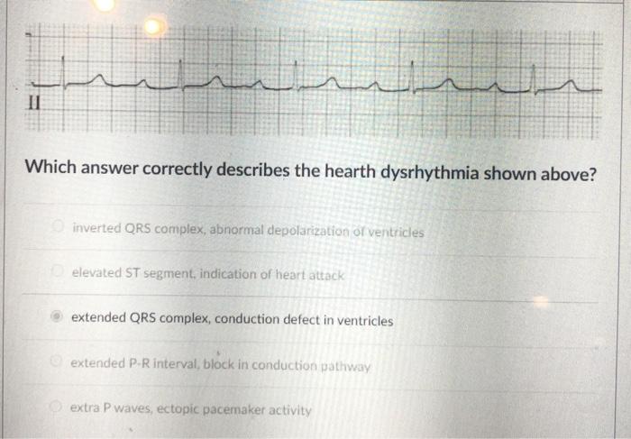 Solved Il Which answer correctly describes the hearth | Chegg.com