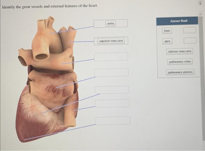 Solved Identify the great vessels and external features of | Chegg.com