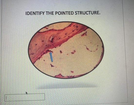 Solved IDENTIFY THE POINTED STRUCTURE. | Chegg.com