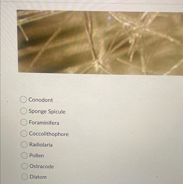 Solved Identify the microfossil pictured | Chegg.com