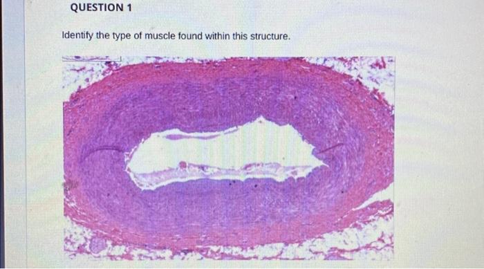 Solved 1.identify the type of muscle found within this | Chegg.com Solved 1.identify the type of muscle found within this | Chegg.com