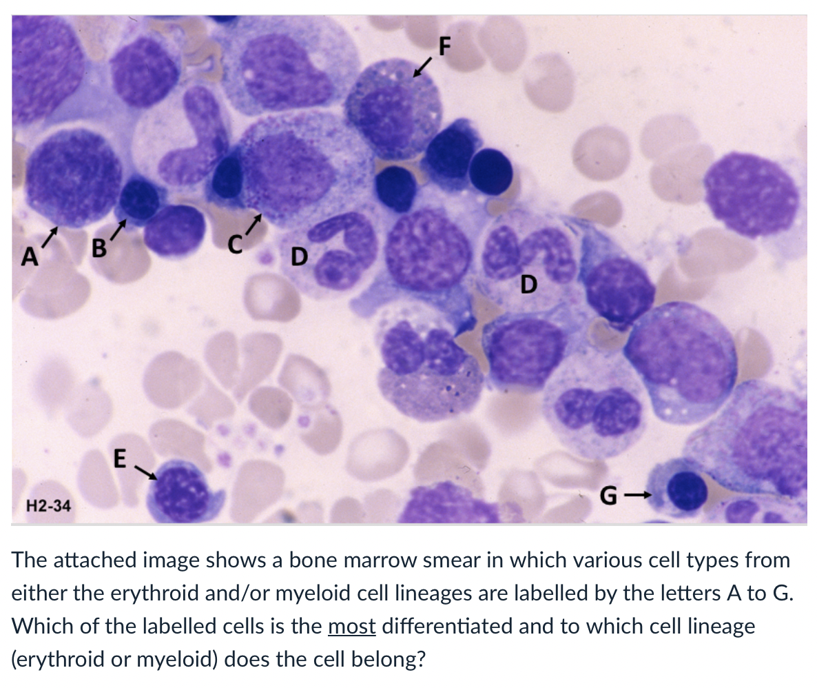Solved The attached image shows a bone marrow smear in which | Chegg.com