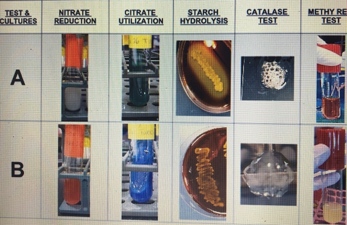 TEST & CULTURES NITRATE REDUCTION CITRATE UTILIZATION | Chegg.com