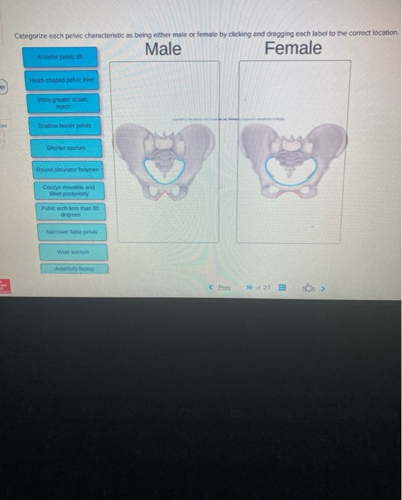 Solved Categorize each pelvic characteristic as being either | Chegg.com