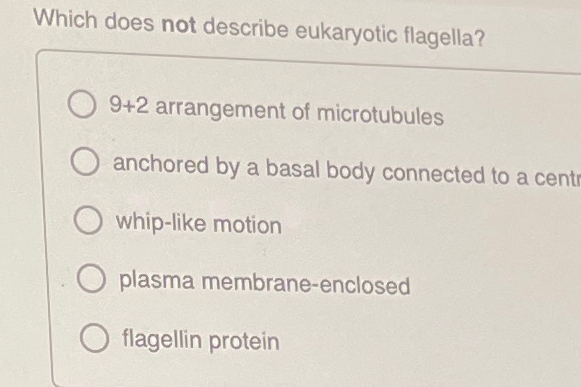 Solved Which does not describe eukaryotic flagella?9+2 | Chegg.com
