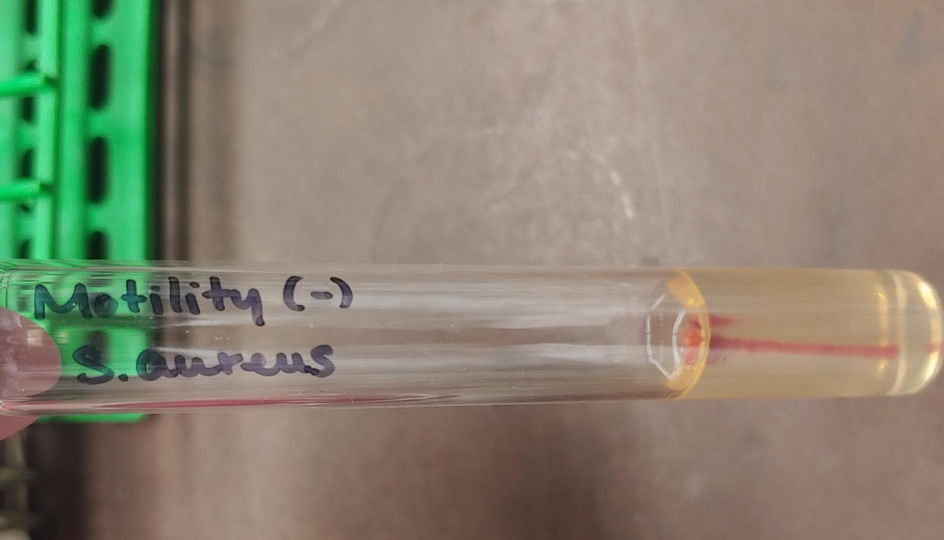 Solved Motility (-) S.aureus Motility (+) Povulgaris 4. | Chegg.com