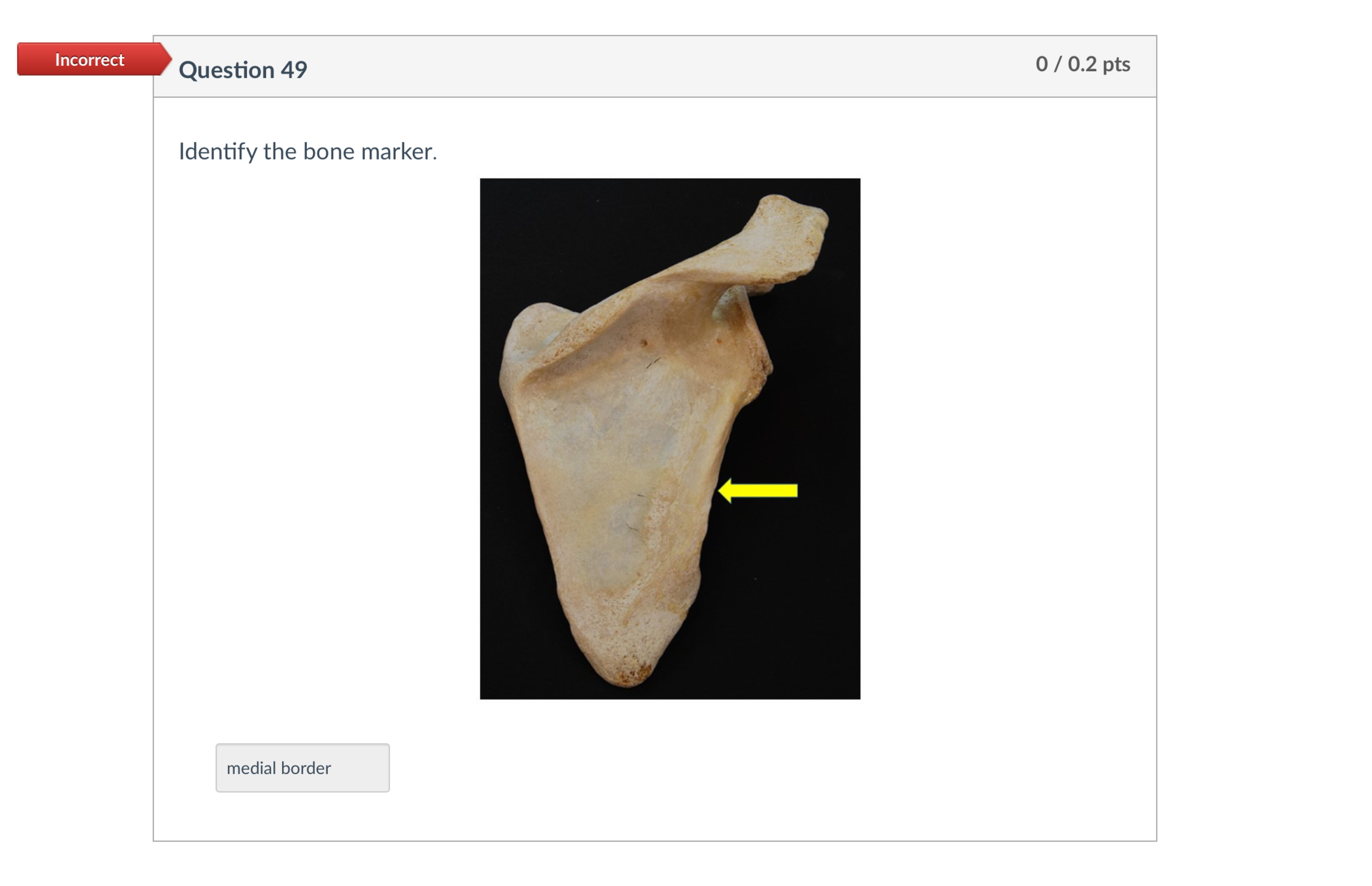 Solved Identify the bone marker.i tried lateral axillary | Chegg.com