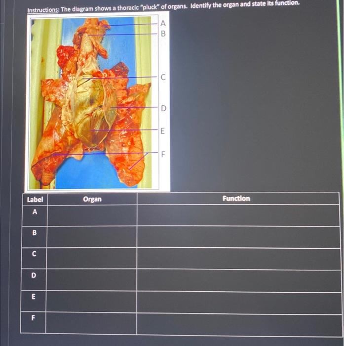 Instructions: The diagram shows a thoracic "pluck" of | Chegg.com