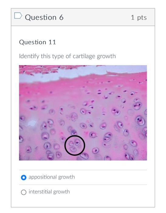 Solved Question 6 Question 11 Identify this type of | Chegg.com