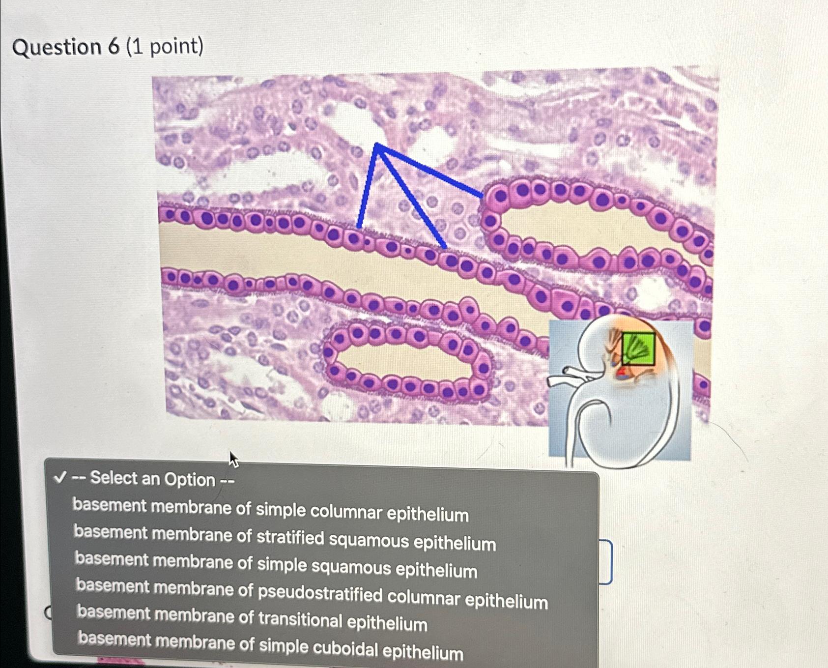 Solved Question 6 (1 ﻿point) -- ﻿Select an Option --basement | Chegg.com