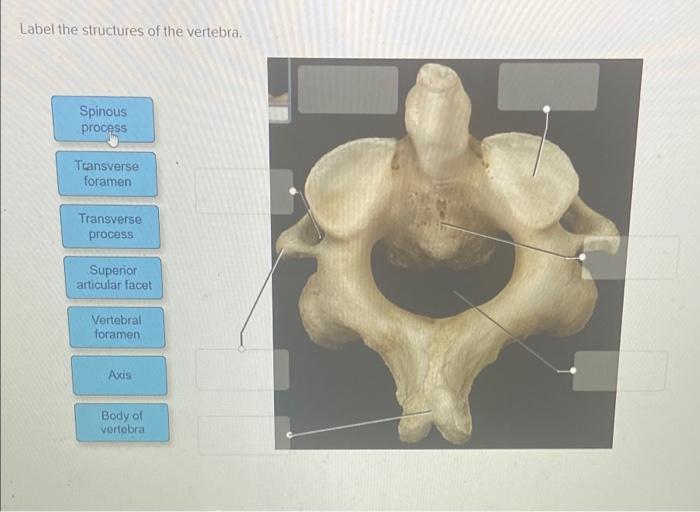Solved Label the structures of the vertebra. Spinous process | Chegg.com