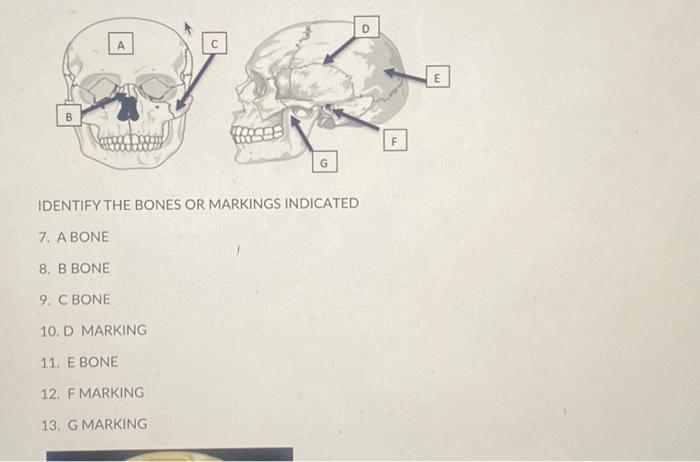 Solved B IDENTIFY THE BONES OR MARKINGS INDICATED 7. A BONE | Chegg.com
