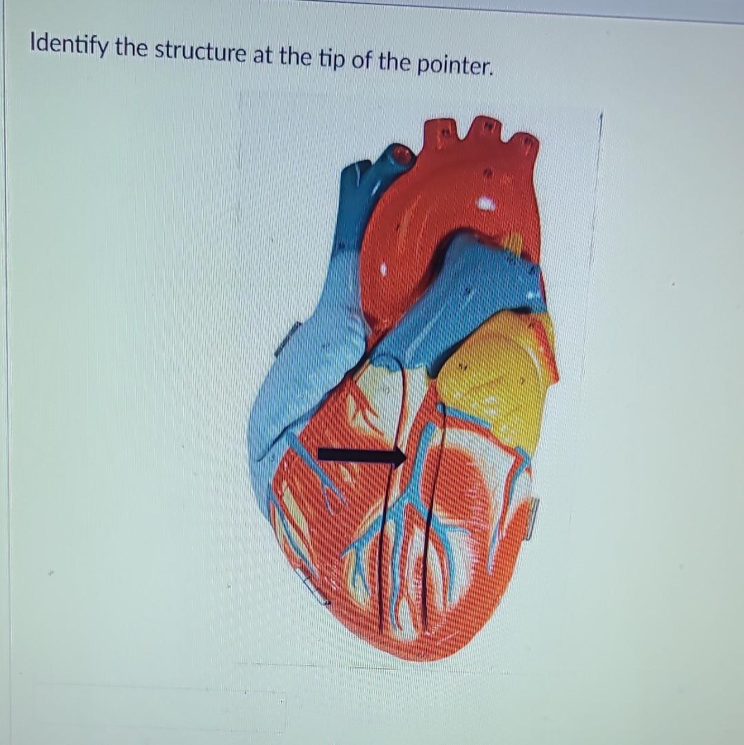Solved Identify the structure at the tip of the | Chegg.com