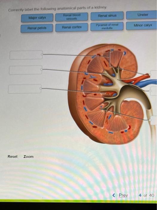 Solved Correctly label the following anatomical parts of a | Chegg.com