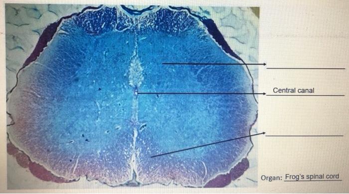Solved Central canal Organ: Frog's spinal cord | Chegg.com