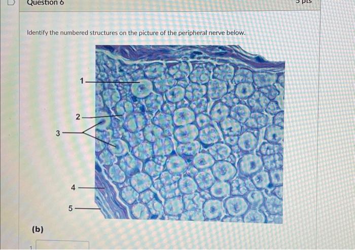 Solved Identify the numbered structures on the picture of | Chegg.com Solved Identify the numbered structures on the picture of | Chegg.com