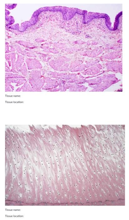 Solved Tissue Name: Tissue Location (only 1): Tissue | Chegg.com
