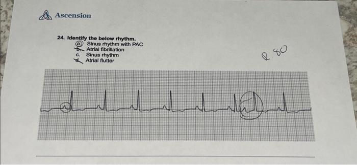 Solved 24. Identify the below rhythm. (a) Sinus rhythm with | Chegg.com