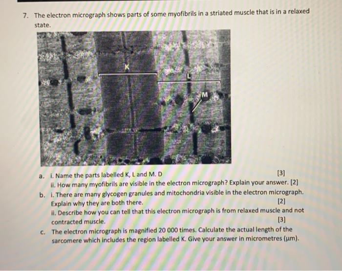 Solved 7. The electron micrograph shows parts of some | Chegg.com