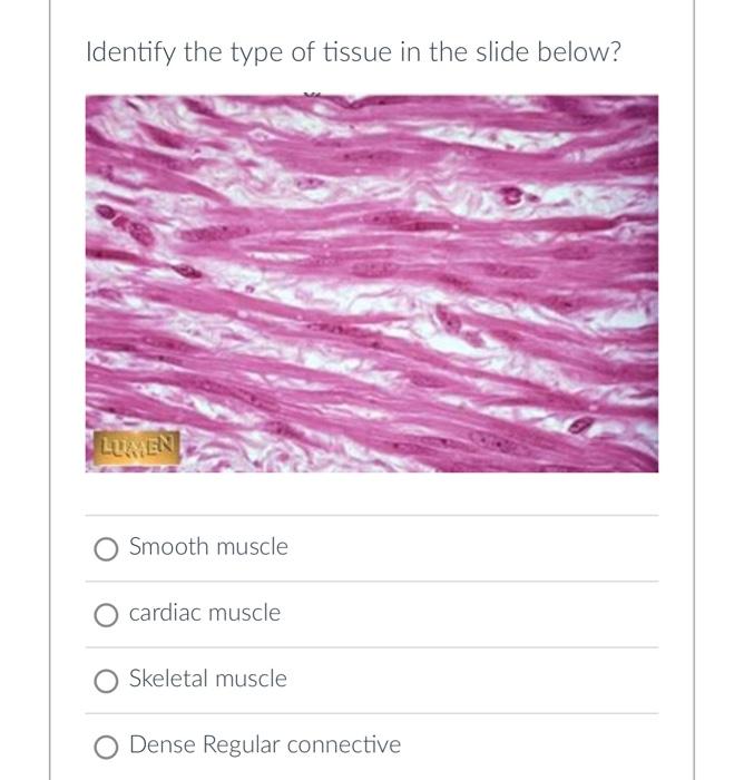 Solved Identify the structure highlighted in blue? Neuron | Chegg.com