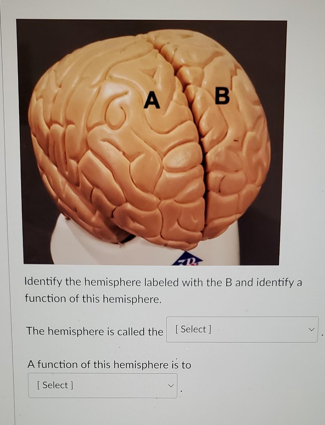Solved Identify the structure at the tip of the arrow. | Chegg.com