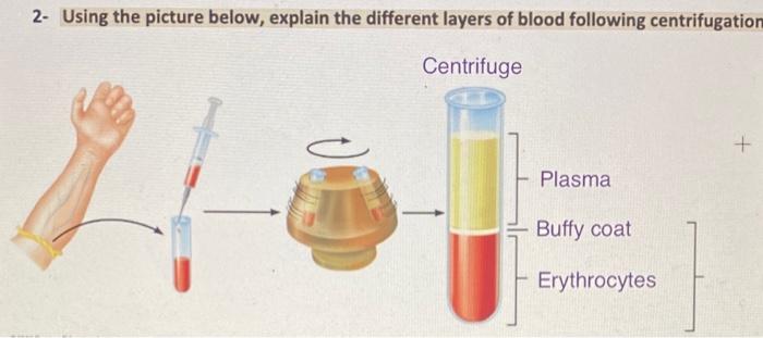 Solved Using the picture below, explain the different layers | Chegg.com