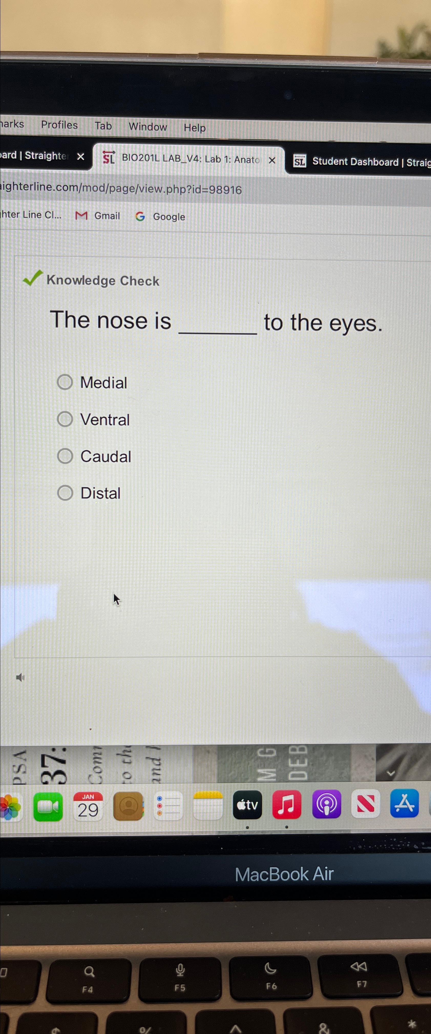 Solved Knowledge CheckThe nose is to the | Chegg.com