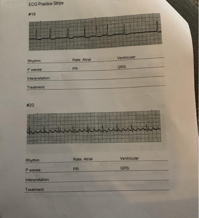 Solved ECG Practice Strips #19 Rhythm: Rate: Atrial | Chegg.com