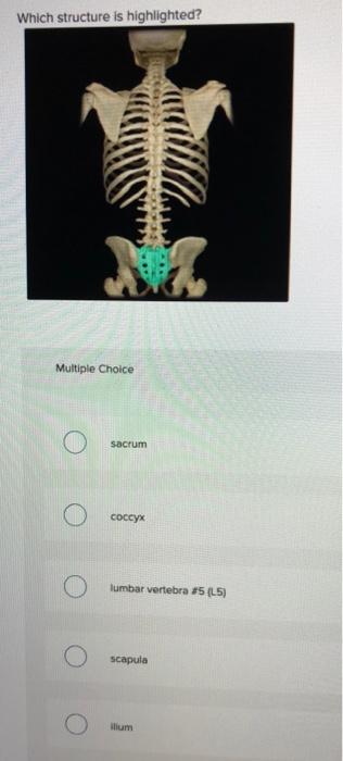 Solved Which structure is highlighted? Multiple Choice O O O | Chegg.com