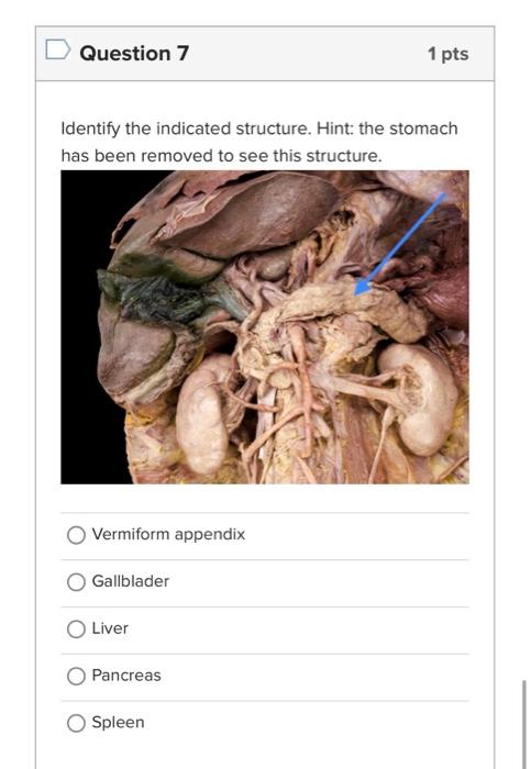 Solved Question 7 1 pts Identify the indicated structure. | Chegg.com