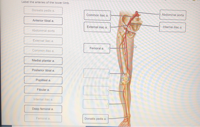 Solved Label the carotid arteries and the branches of the | Chegg.com