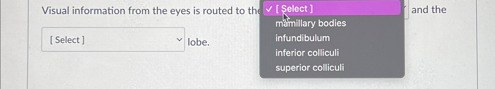 Solved Visual information from the eyes is routed to the | Chegg.com
