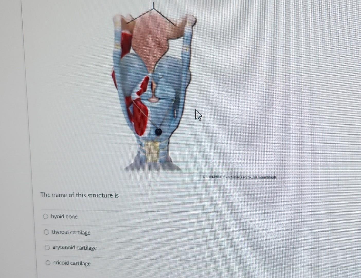 Solved The name of this structure is hyoid bone thyroid | Chegg.com