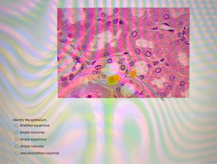 Solved Identify the epithelium stratified squamous simple | Chegg.com