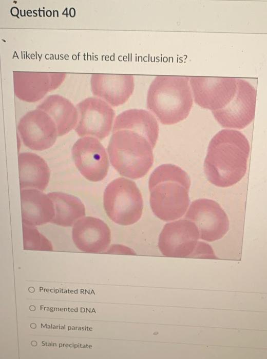 Solved identify the cell Lymphocyte O Nucleated red blood | Chegg.com