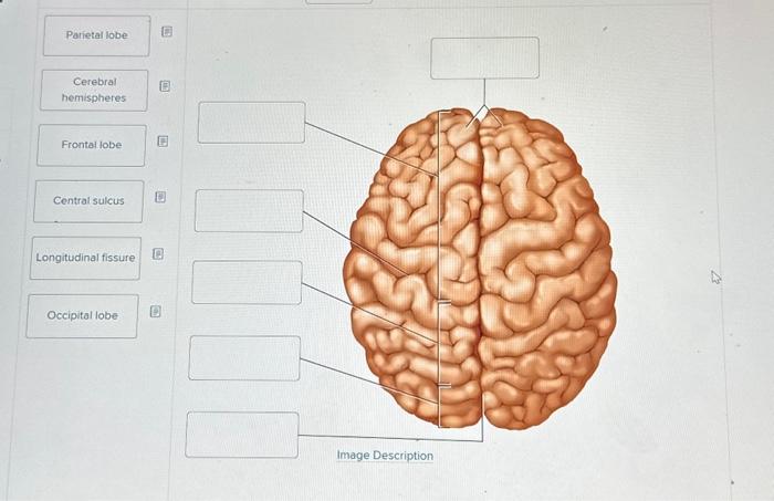 Solved Parietal lobe Cerebral hemispheres Frontal lobe | Chegg.com