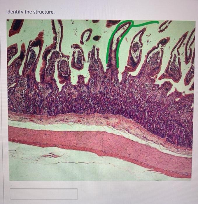 Solved Identify the structure. | Chegg.com
