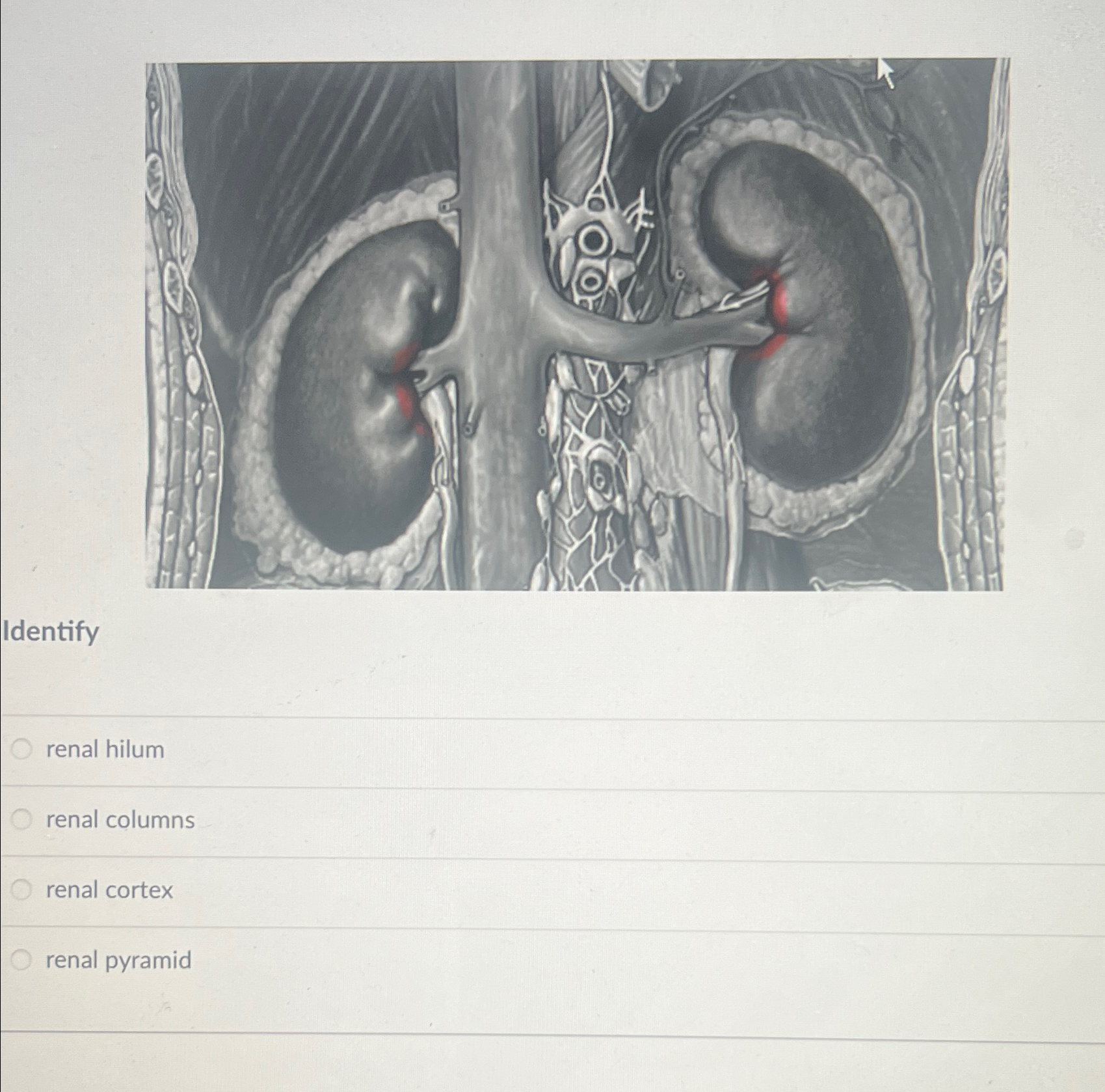 Solved Identifyrenal hilumrenal columnsrenal cortexrenal | Chegg.com