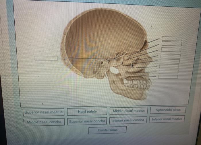 Solved Hard palete Middle nasal meatus Superior nasal meatus | Chegg.com