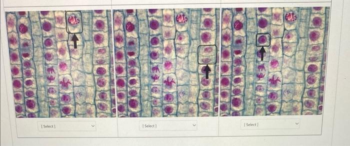 Solved In what phase of the cell cycle/mitosis are the | Chegg.com