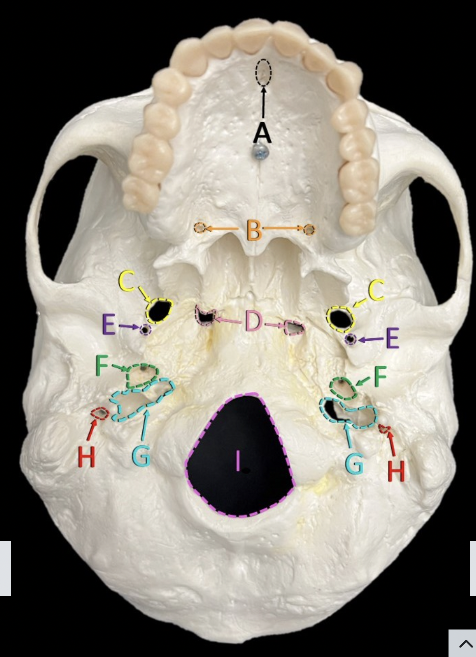 Solved base of human skull label. answer options in photo. | Chegg.com