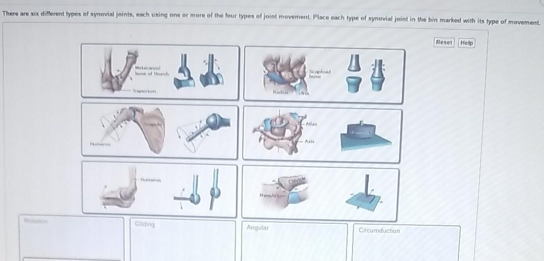 Solved There are six different types of synovial joints, | Chegg.com